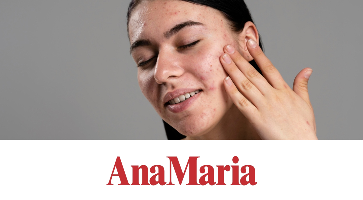 Como o tempo seco afeta o corpo? Aprenda a cuidar da pele